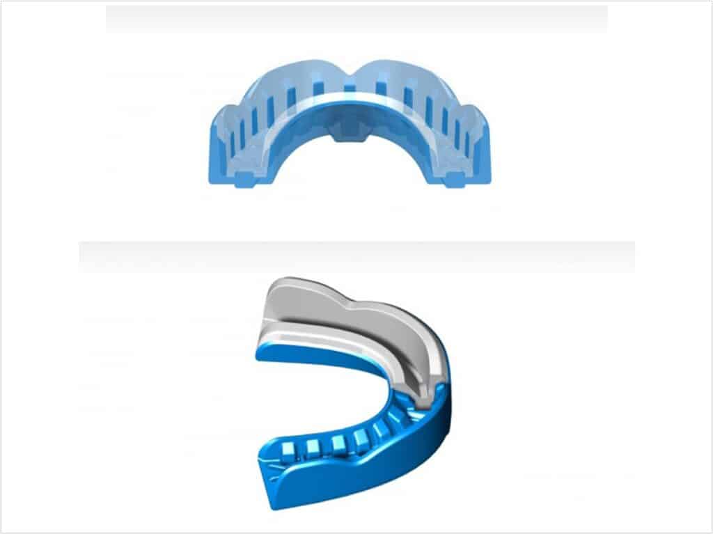 Smart Mouthguard Technology Gets Licensing Deal - Dentistry Today