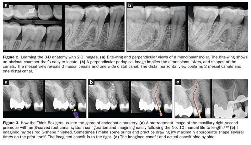 The Set Up: Endodontic Predictability - Dentistry Today