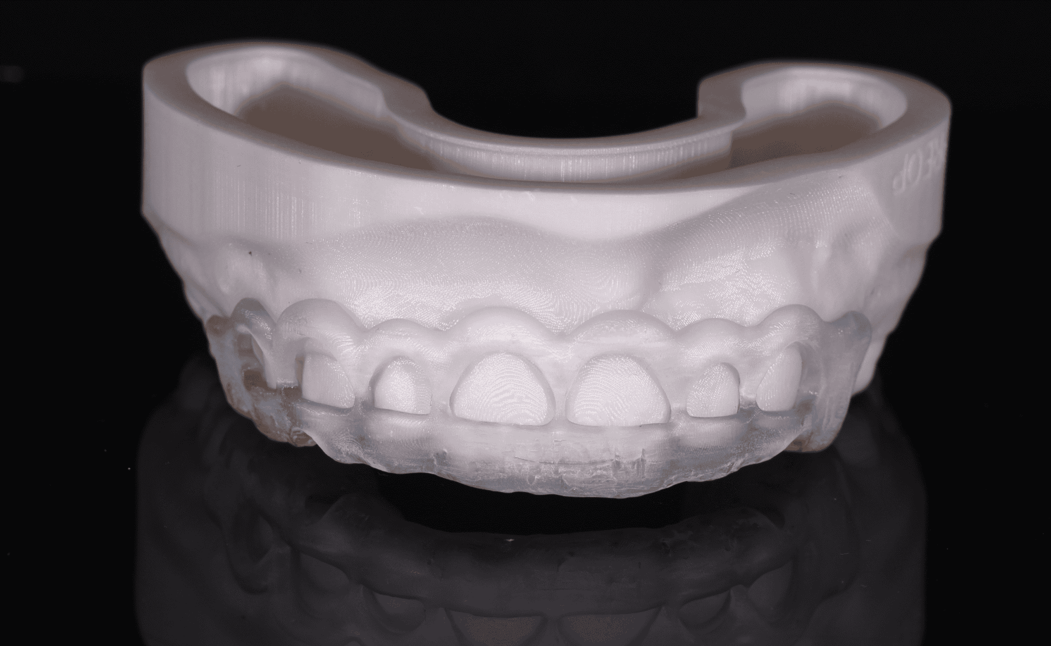 Aesthetic Crown Lengthening Utilizing a Digital Workflow - Dentistry Today