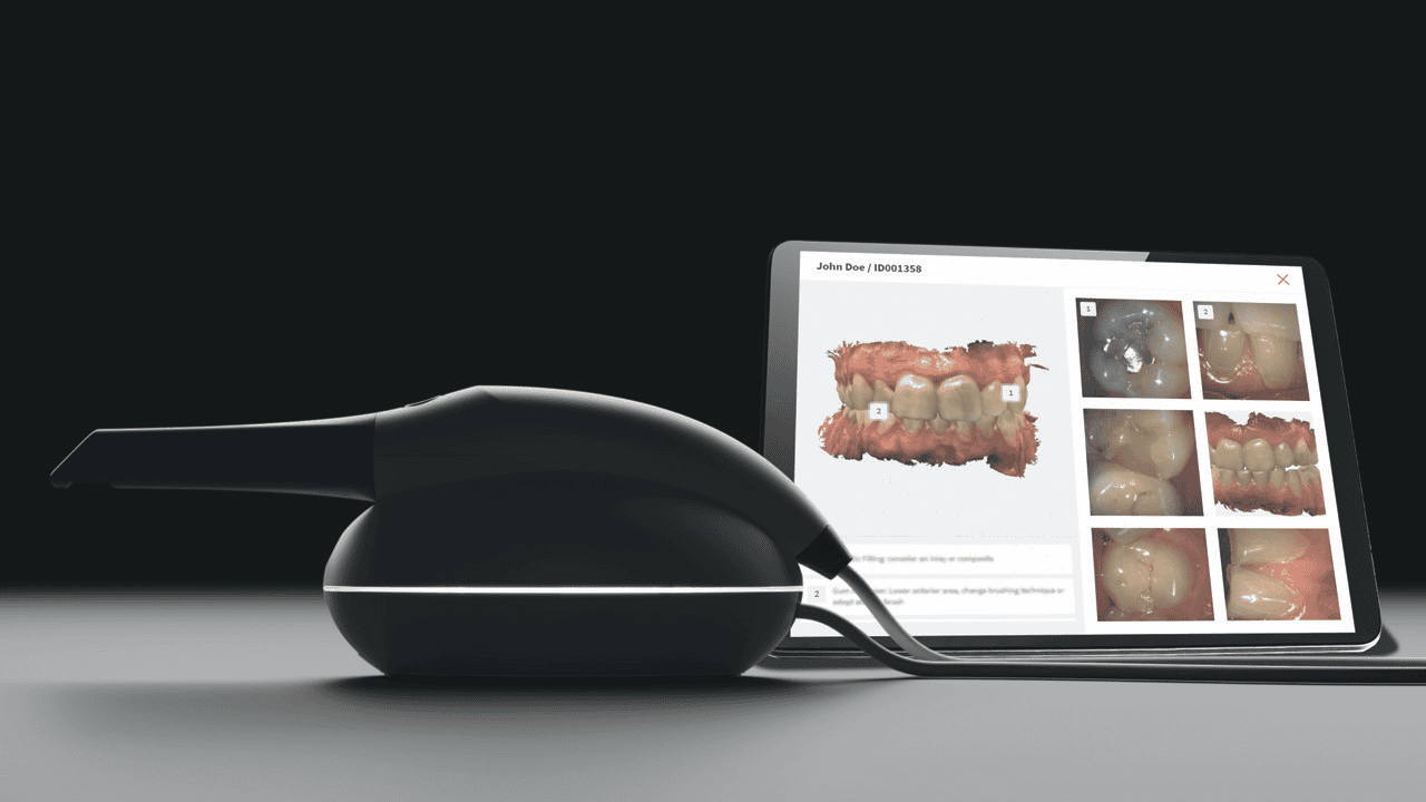 OVO - Scanner Offers Visualization of Each Patient’s Dental Health