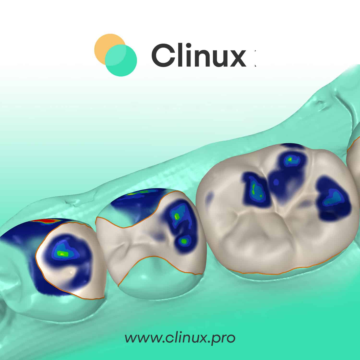 Clinux CAD Offers New Possibilities for Dentists with Innovative ...