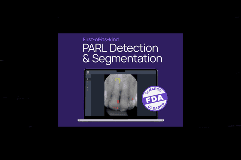 Overjet Announces FDA Approval for First-of-its-Kind PARL Segmentation ...