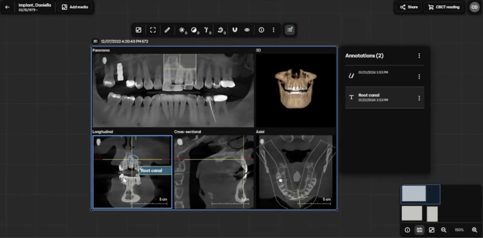DS Core Enhances Dental Workflows With New Historical Data Integration ...