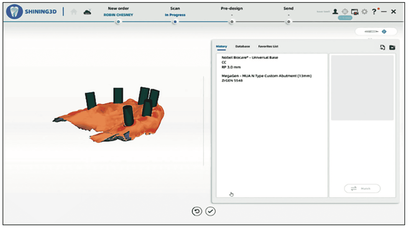 Intraoral Photogrammetry: The Next Step in Full-Arch Implant Precision ...
