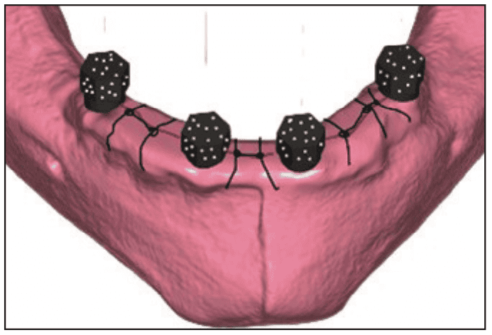 The One-Scan Technique: Digitizing and Streamlining the Surgical Record ...